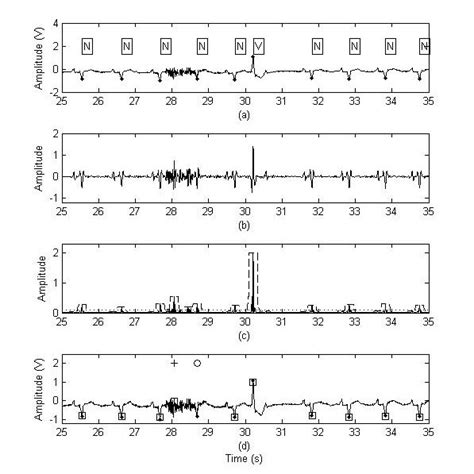 the block diagram of proposed r peak detection algorithm download scientific diagram