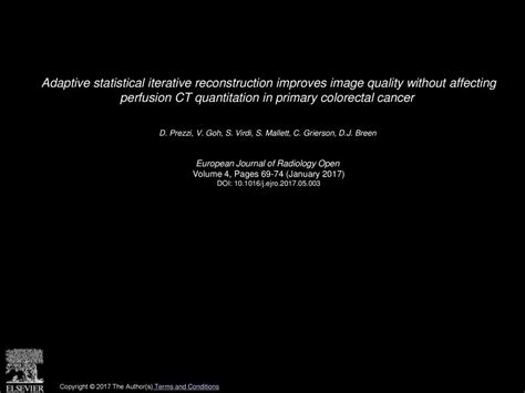 adaptive statistical iterative reconstruction improves image quality without affecting perfusion