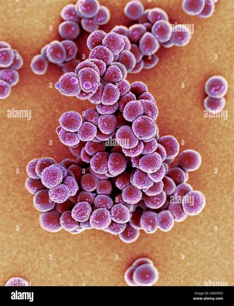 MRSA Bacteria Coloured Scanning Electron Micrograph SEM Of