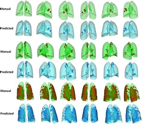 representative manual and predicted segmentation 3d views of lungs download scientific