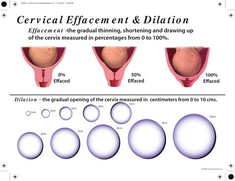 Cervical Effacement Dilation Cervical Effacement Cervix Dilation Cervix Dilation Chart