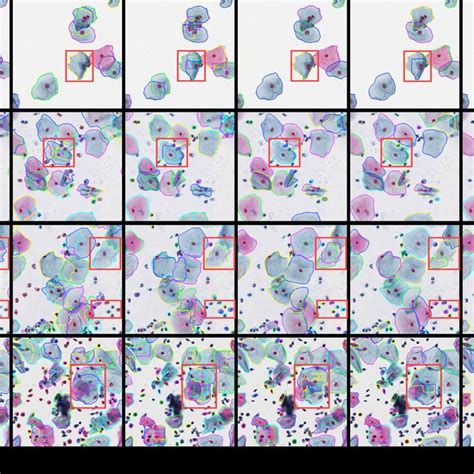 pdf irnet instance relation network for overlapping cervical cell segmentation