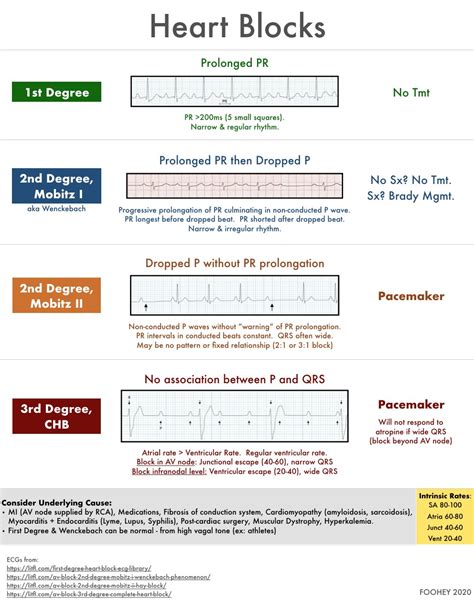 Different Types Of Heart Blocks