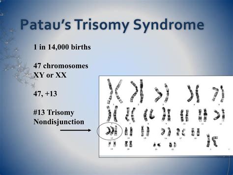 Ppt Nondisjunction Disorders Powerpoint Presentation Free Download Id266480