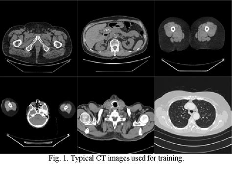 figure 1 from low dose ct denoising with convolutional neural network semantic scholar