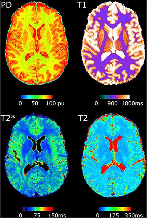 frontiers multiparametric quantitative mri in neurological diseases