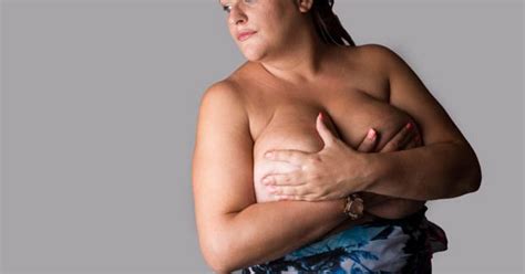 Single Mum Refused Surgery On NHS My 38KK Boobs Are Ruining My Life