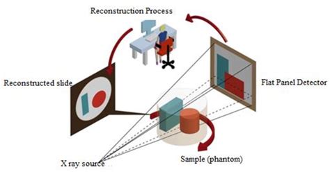figure 1 from evaluation of image reconstruction algorithms in cone beam computed tomography