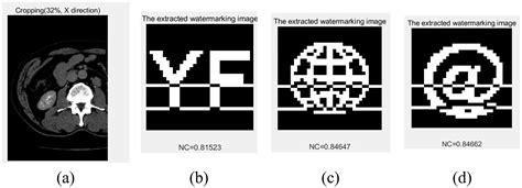 cmc free full text a multi watermarking algorithm for medical images using inception v3 and dct