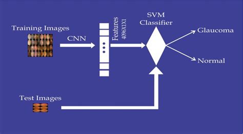 figure 2 from automated identification of glaucoma from fundus images using deep learning