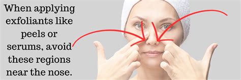 Dry Skin Around Nose Board Certified Dermatologist Explains Causes Symptoms And Treatment Options