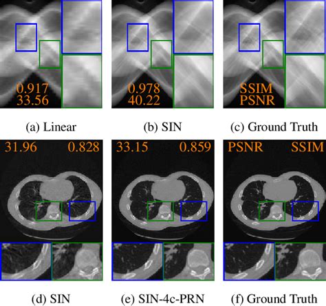 figure 7 from 2 step sparse view ct reconstruction with a domain specific perceptual network