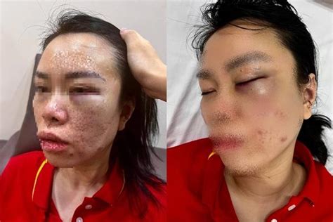 Người phụ nữ bị chồng cũ bắt giữ đánh đập dã man suốt 1 ngày 2sao