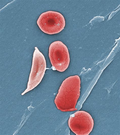Public Domain Picture This Digitally Colorized Scanning Electron