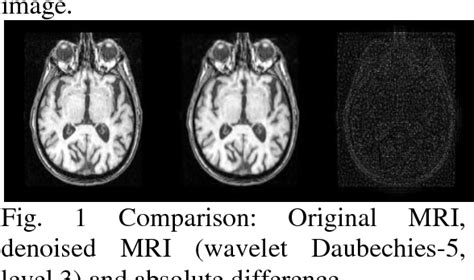 figure 1 from brain tissue segmentation in medical image analysis using self organizing maps