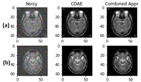 denoising results using fuzzy filtering and combined approach 64 × download scientific