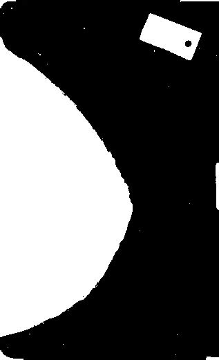 Python OpenCV Segmentation Of Largest Contour In Breast Mammograms