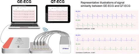 validation of 12 lead ecg signals between devices the proposed deep download scientific