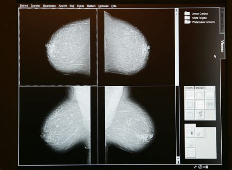 6 Surprising Things You Didnt Know About Your Breasts