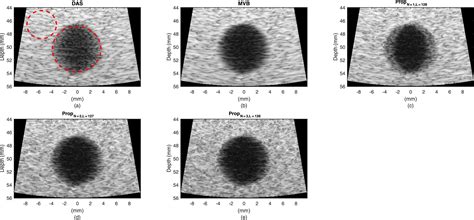 high resolution minimum variance beamformer with low complexity in medical ultrasound imaging