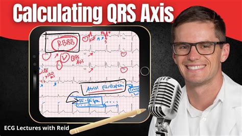 How To Calculate QRS Axis 3 Methods EKG ECG Lecture YouTube