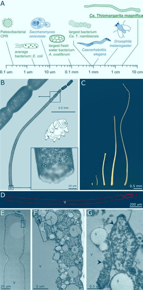 Newly Discovered Species Of Bacterium Is Visible To Naked Eye Sci News