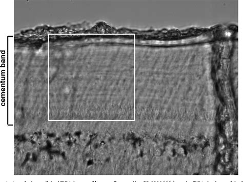 figure 1 from hidden markov random field and frame modelling for tca image analysis semantic
