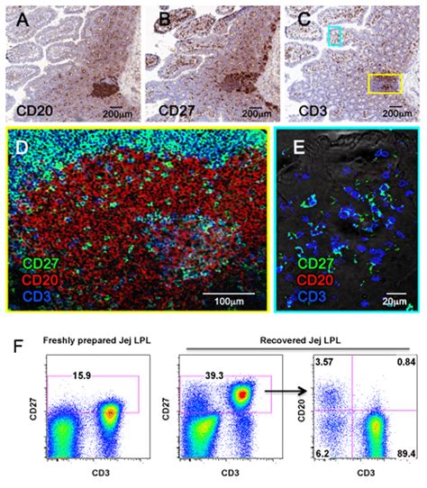 Identification And Localization Of CD27 Cell Subsets In Intestinal