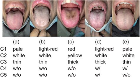 Chinese Medicine Tongue Reading: Beyond the Basics (Expert Guide ...