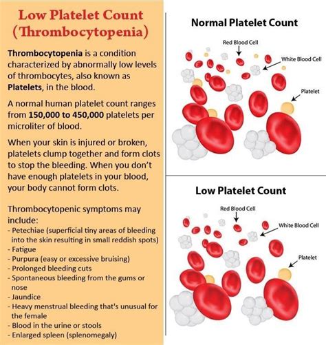 Low Platelets Meaning Explained Simply - DID YOU KNOW!