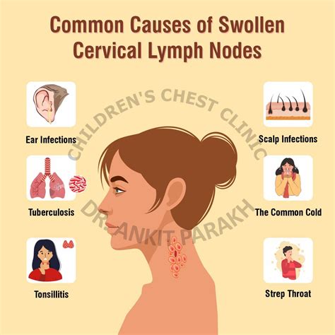 What Do Swollen Cervical Lymph Nodes Really Mean? - Berkeley Learning Hub