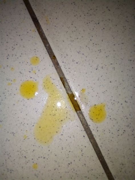 Yellow Fluid Leaking From Nose - Exclusive Behind The Scenes